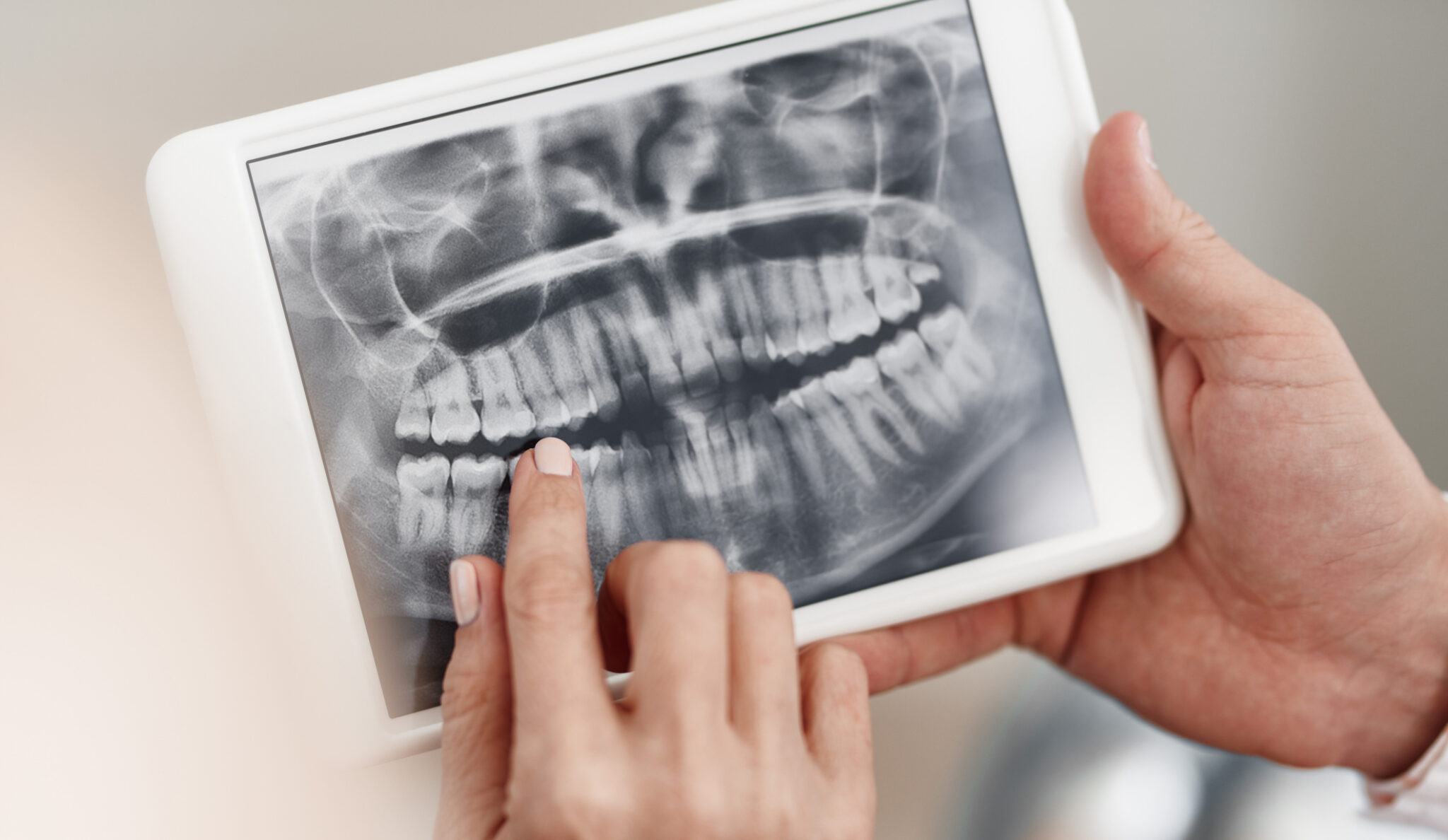 X-ray ทางทันตกรรม อันตรายจริงหรือไม่? - Smile Delight Dental Clinic